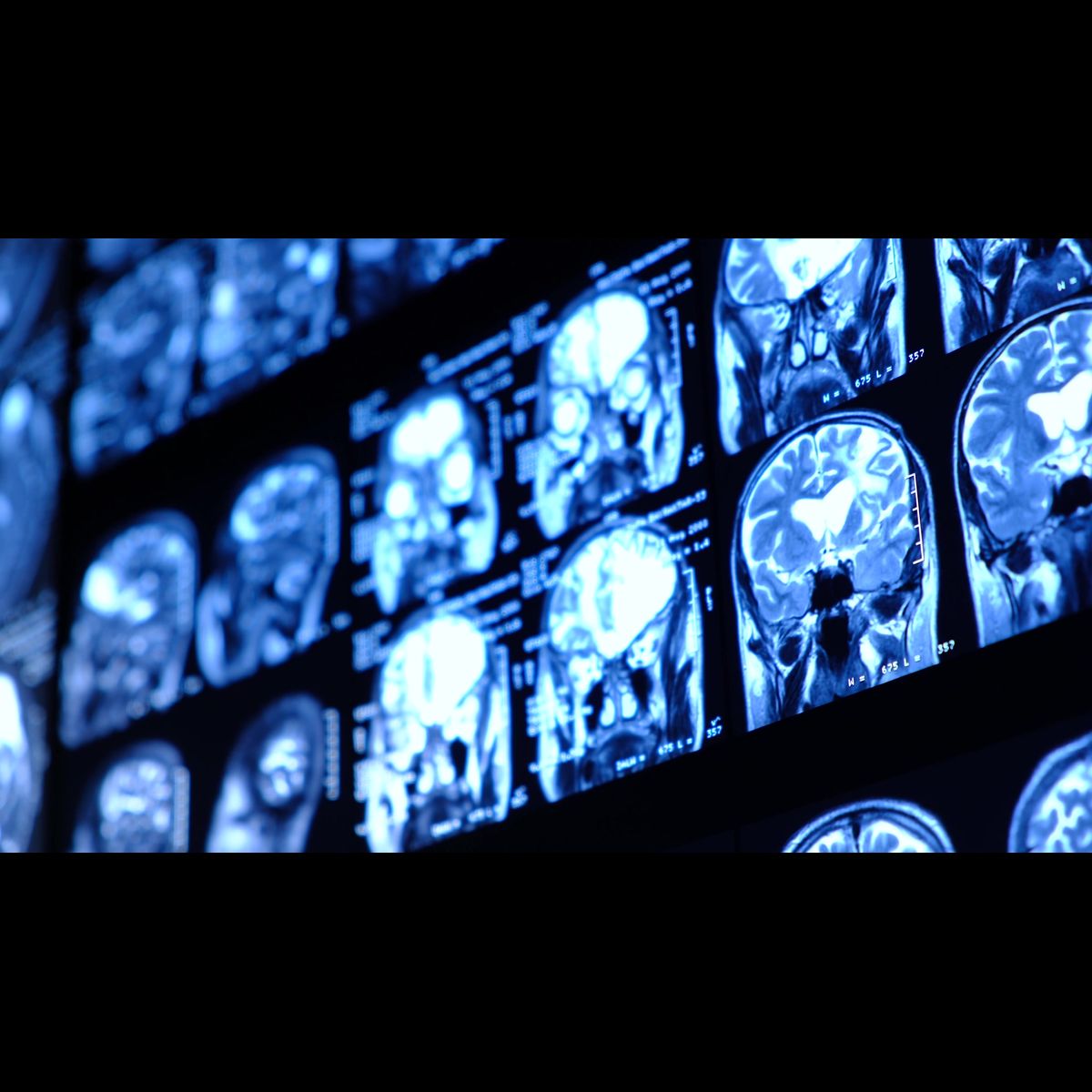 Brain injury news - issue 37